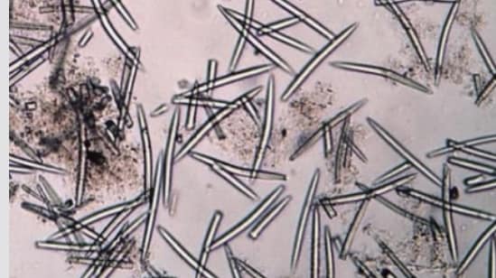 Spicules: Transforming Skincare with Natural Innovation